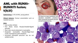Acute myeloid leukemia.pptx Acute myeloid leukemia.pptx
