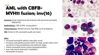 Acute myeloid leukemia.pptx Acute myeloid leukemia.pptx
