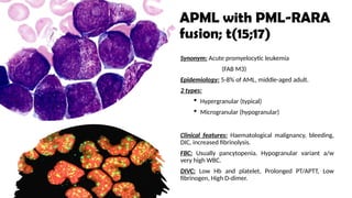 Acute myeloid leukemia.pptx Acute myeloid leukemia.pptx