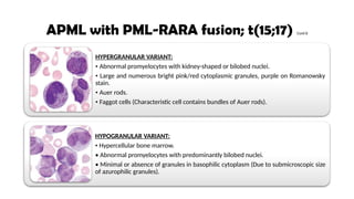 Acute myeloid leukemia.pptx Acute myeloid leukemia.pptx