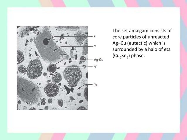 Dental Amalgam & Mercury Toxicity | PPTX