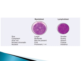 Lymphoblast Vs Myeloblast