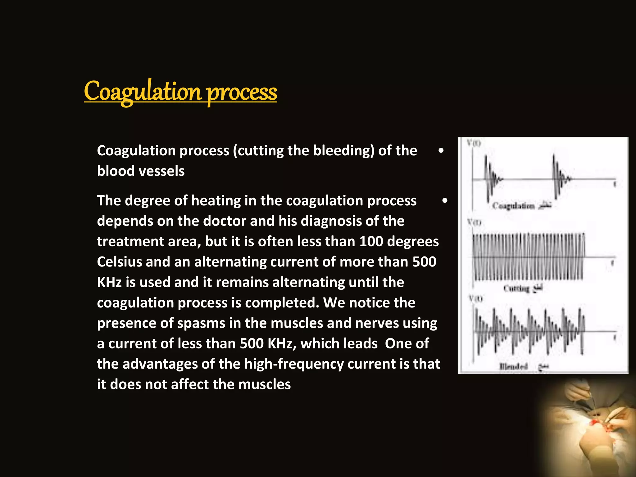 Electrical surgery.pptx