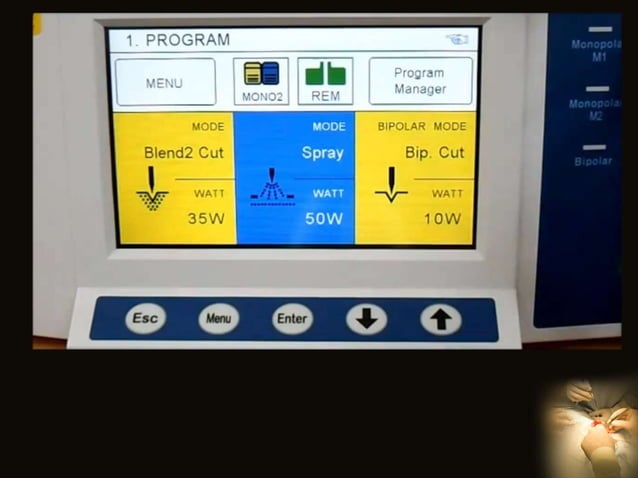 Electrical surgery.pptx