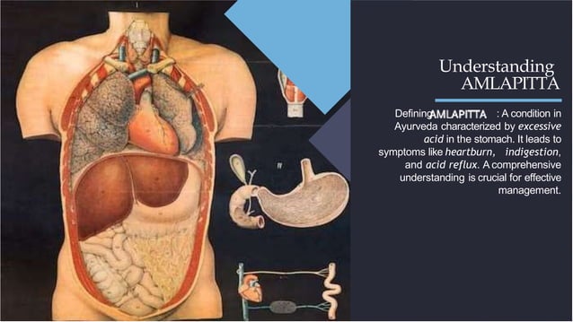 Amlapitta.pptx | Herbs and Supplements | Alternative Medicine