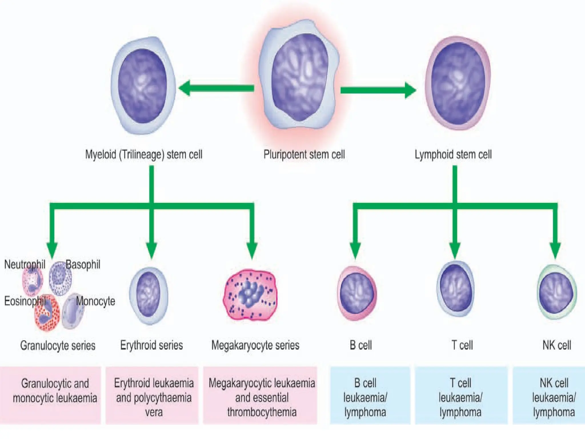 Acute Myeloid Leukemia Classification.pptx