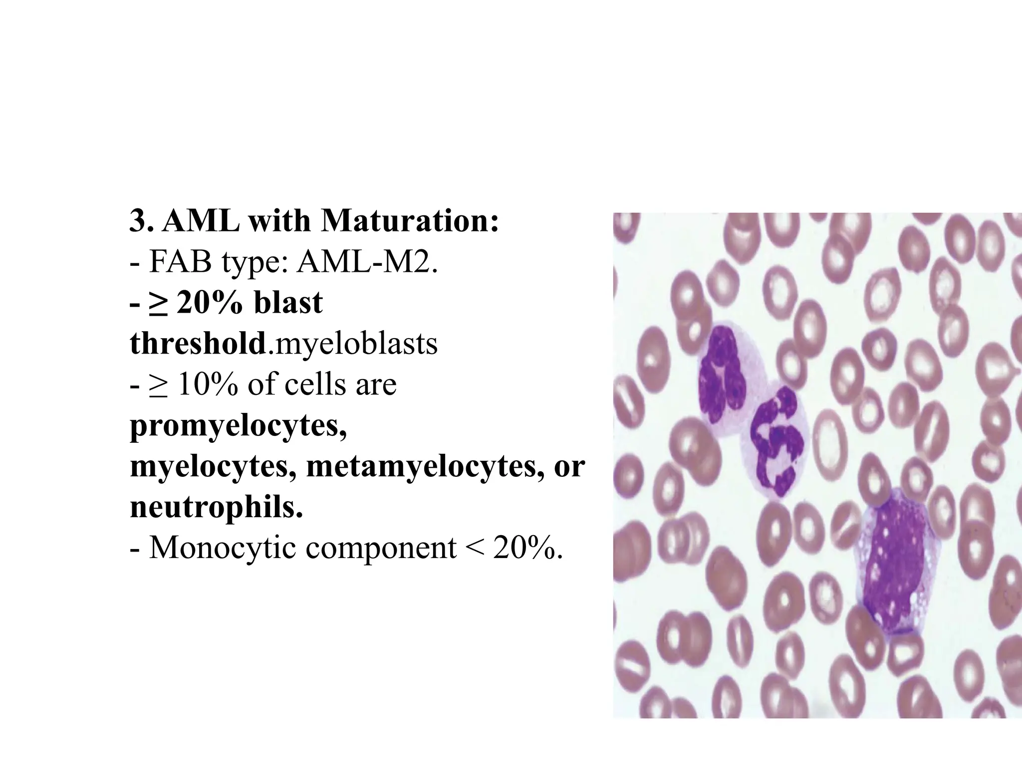 Acute Myeloid Leukemia Classification.pptx