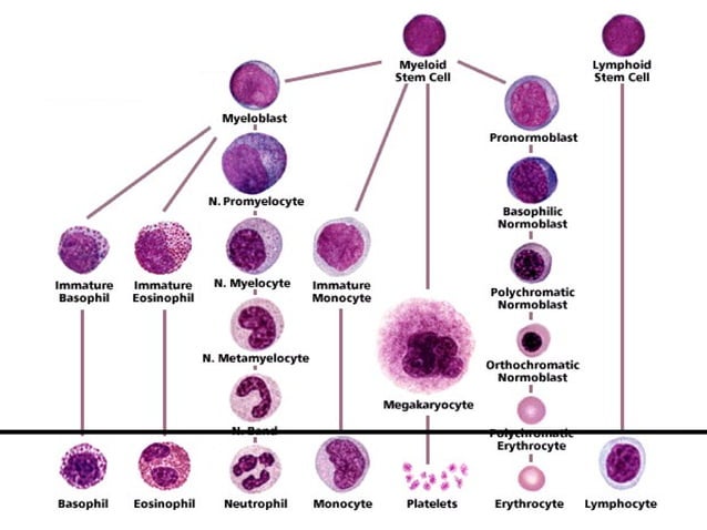 Acute Myeloid Leukemia Classification.pptx