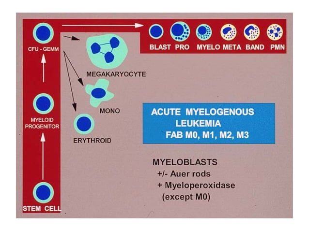 Acute Myeloid Leukemia Classification.pptx