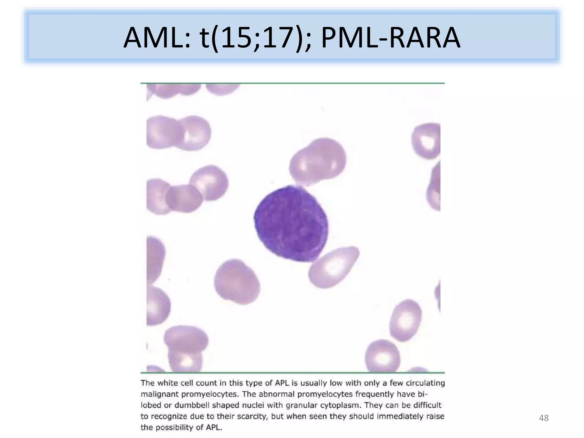 Acute Leukemia Cytogenetics | PPTX