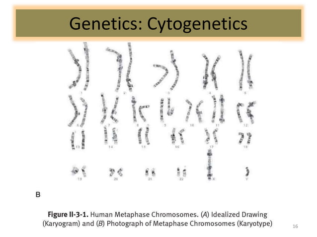 Acute Leukemia Cytogenetics | PPTX