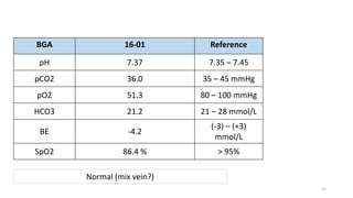 Aml m5 with plasmacytosis kirim | PPTX