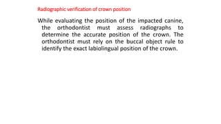 surgical and orthodontic management of impacted maxillary canines part ...