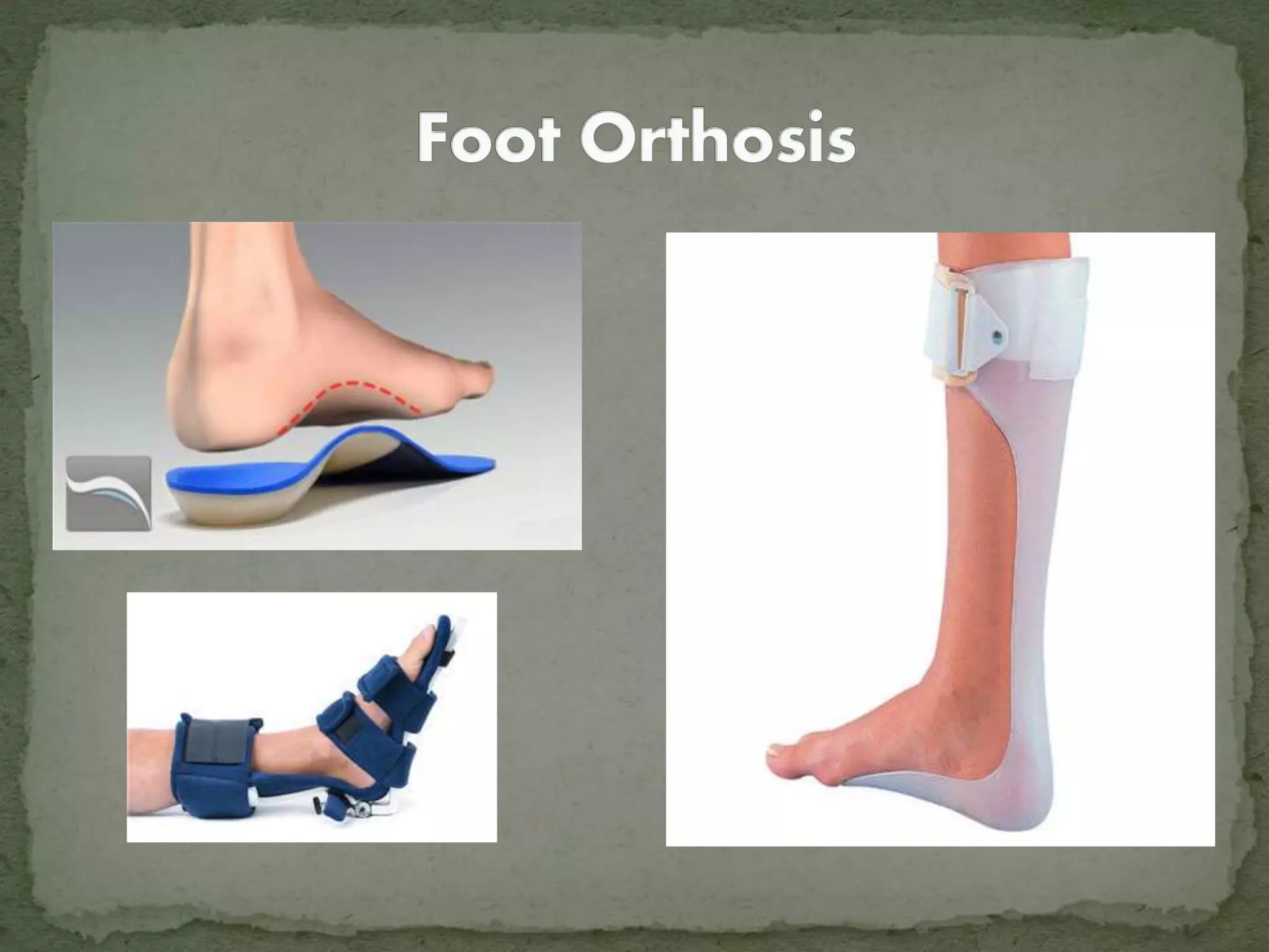 Physiotherapy in Pakistan (Prosthetics and Orthotics) | PPTX