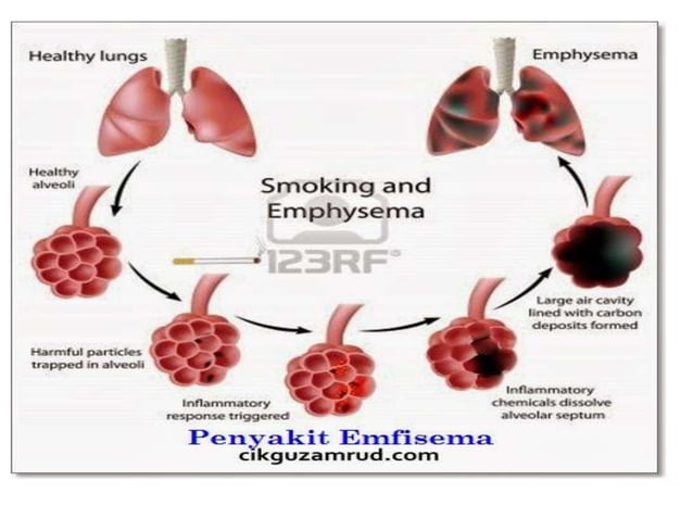 BAHAN PENCEMARAN DAN PEPARU | PPT
