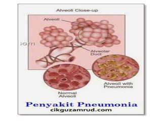 BAHAN PENCEMARAN DAN PEPARU | PPT