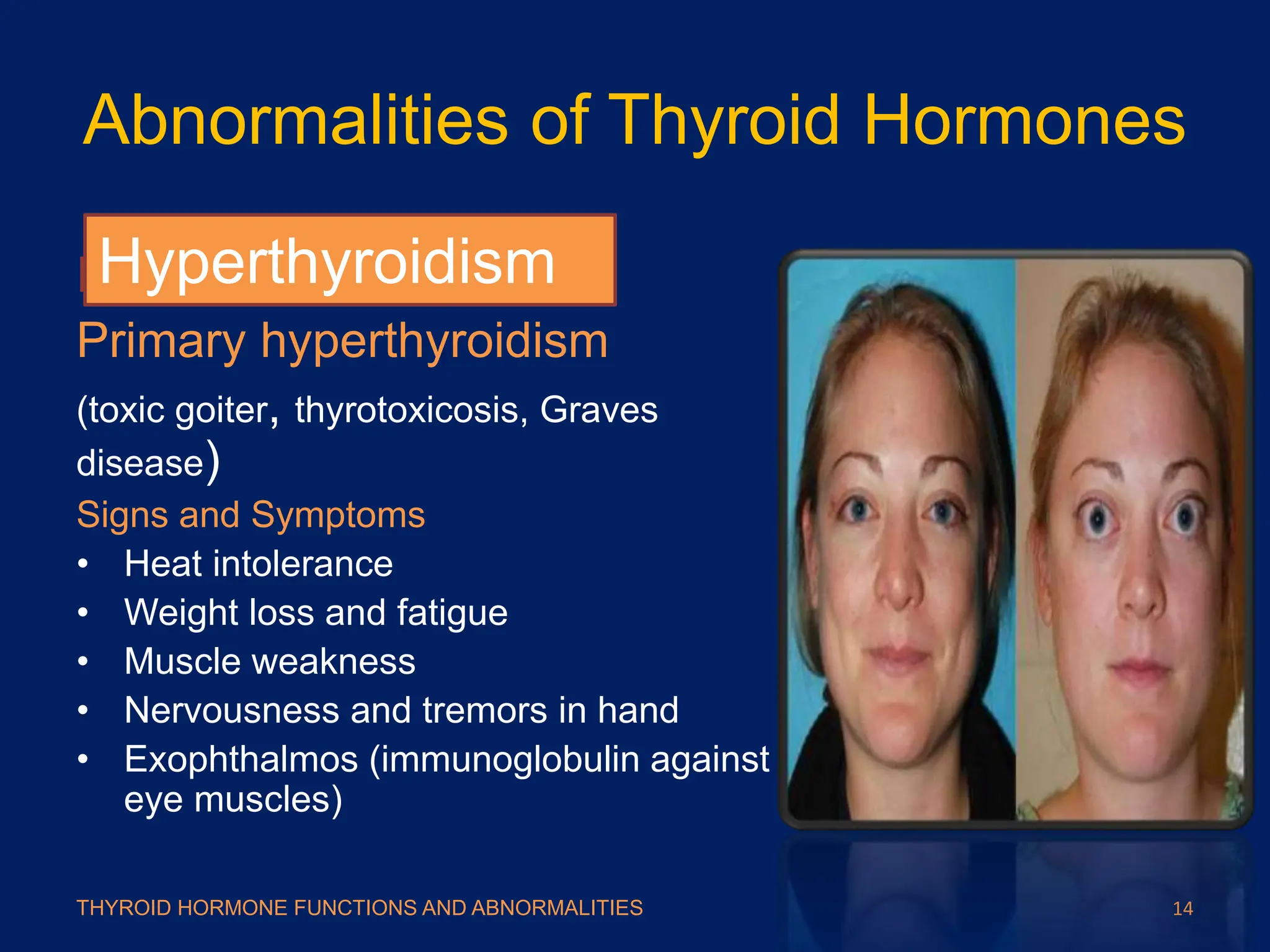 Ammended Thyroid hormone Functions and Abnormalities (1).pptx
