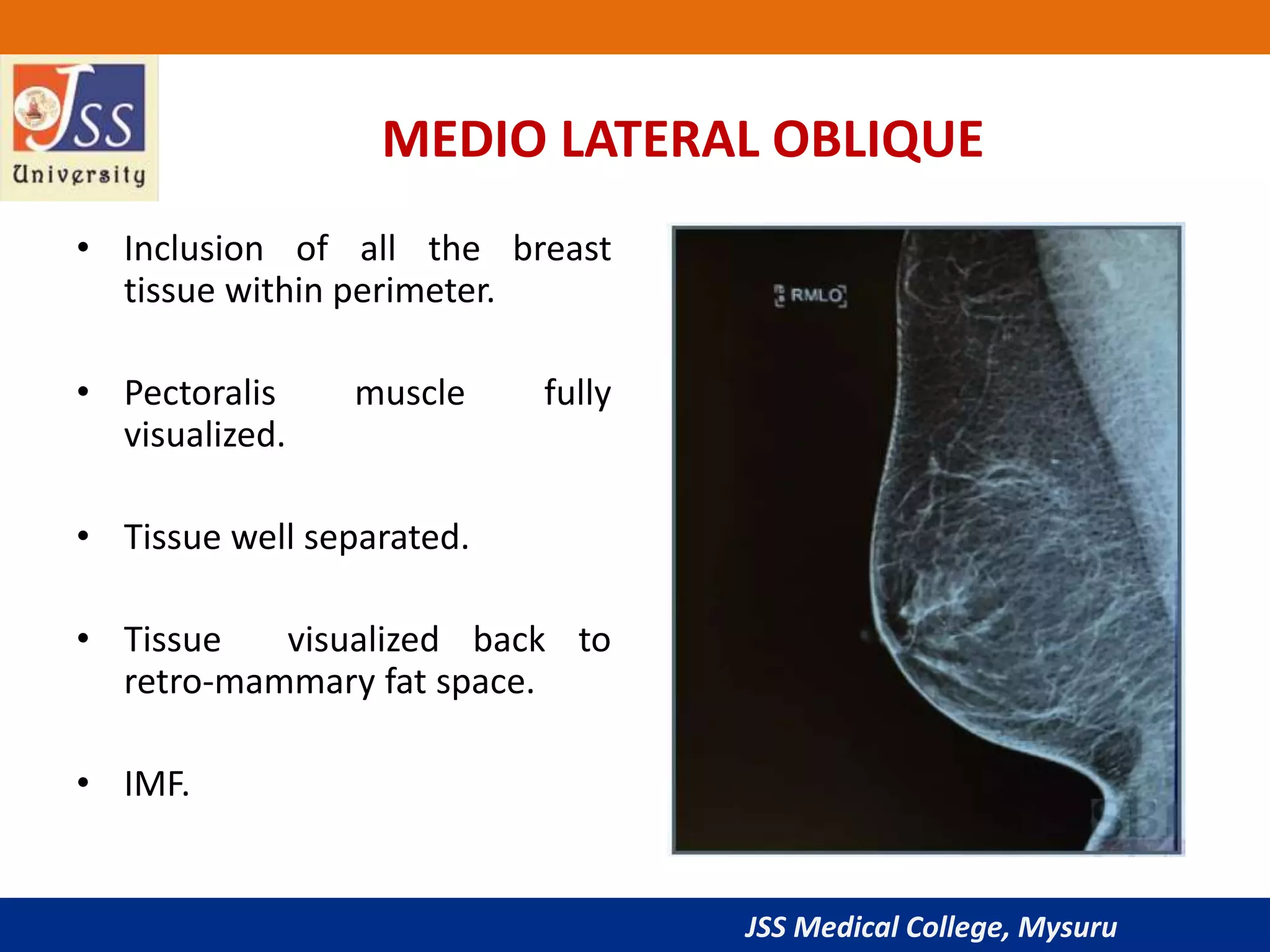 Mammography technique | PPTX