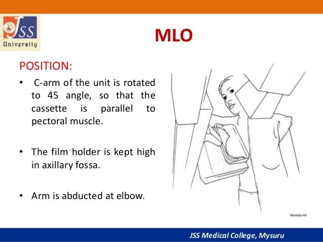 Mammography technique