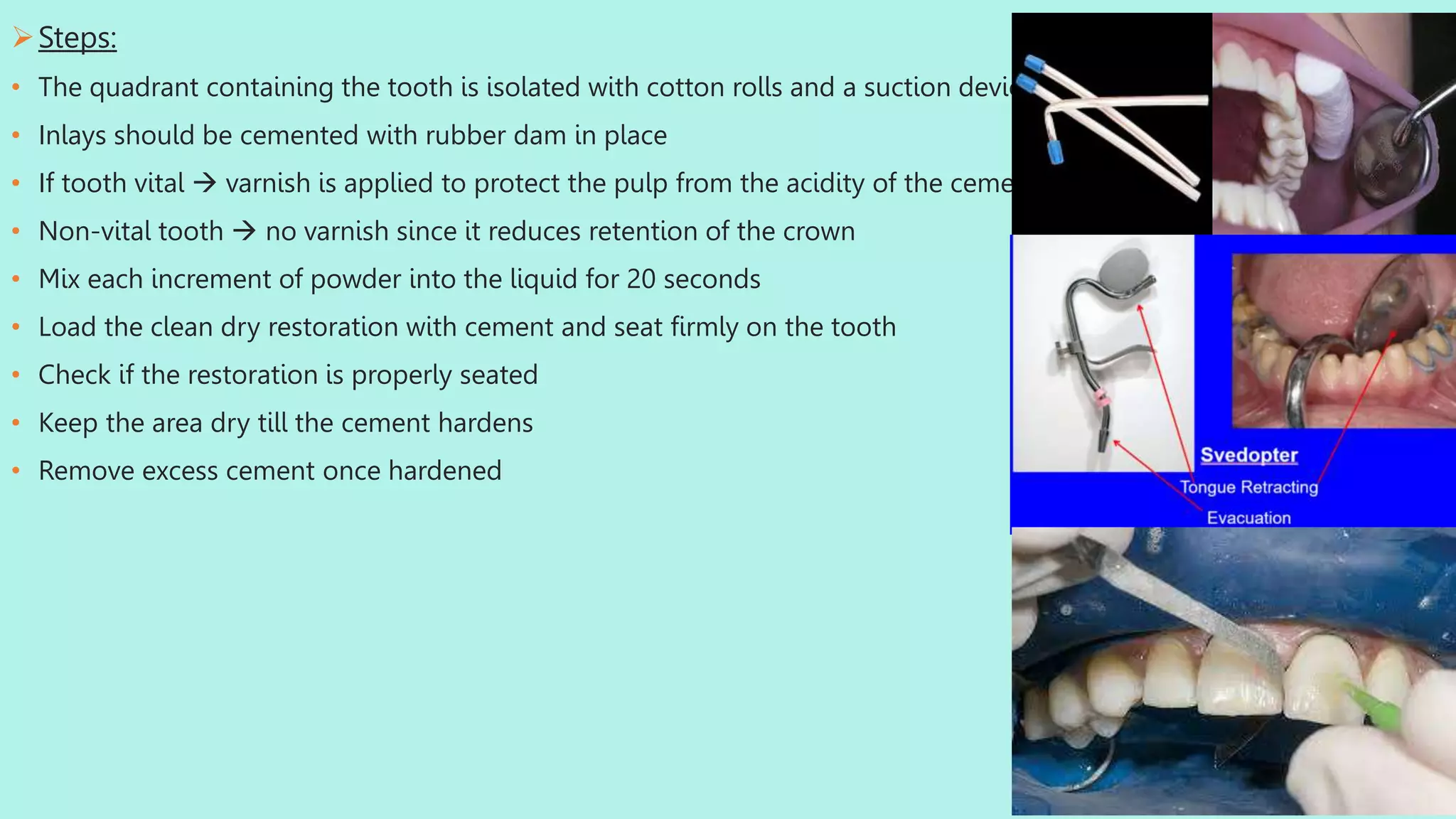 Preparation of tooth-surface before cementation | PPTX