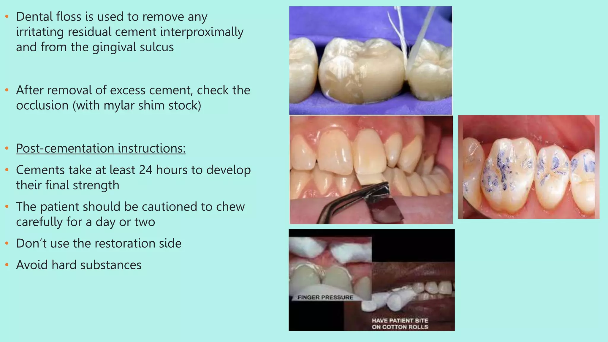 Preparation of tooth-surface before cementation | PPTX