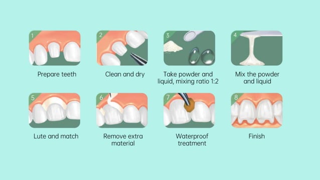 Preparation of tooth-surface before cementation | PPTX