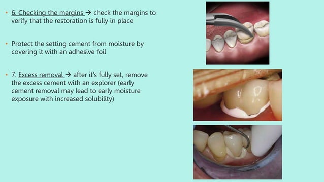 Preparation of tooth-surface before cementation | PPTX