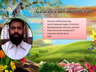 Amnesia | PPTX