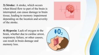 Amnesia, causes, clinical features, epidemiology, types, diagnostic ...