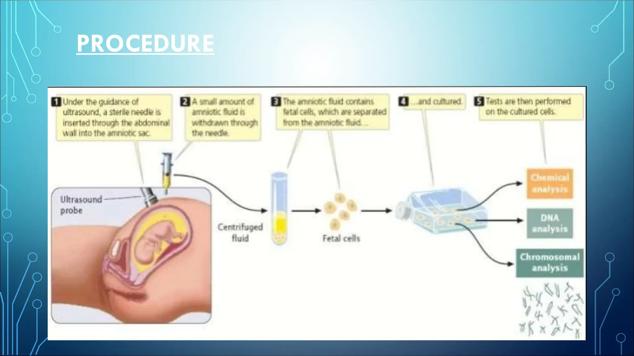 Amniocentesis is a detection process to embrionic | PPT