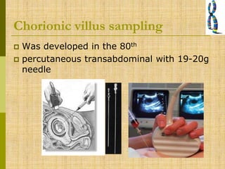 methods of Chromosomal Evaluation in Amniocentesis- Define, Time for ...
