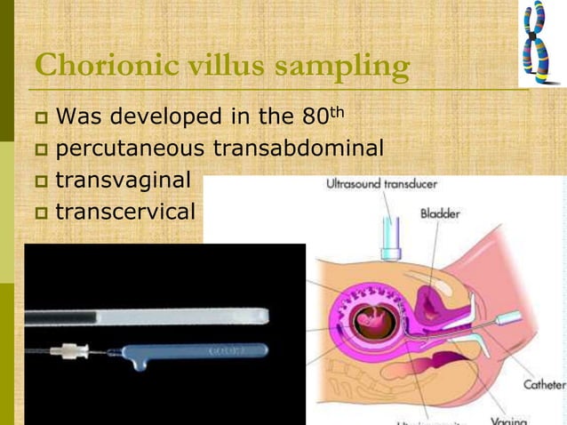 methods of Chromosomal Evaluation in Amniocentesis- Define, Time for ...