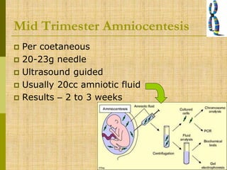 Amniocentesis Results