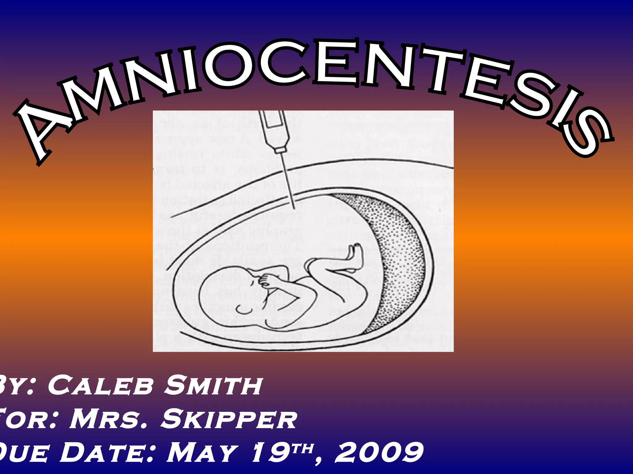 Amniocentesis ((Slide Show)) | PPT