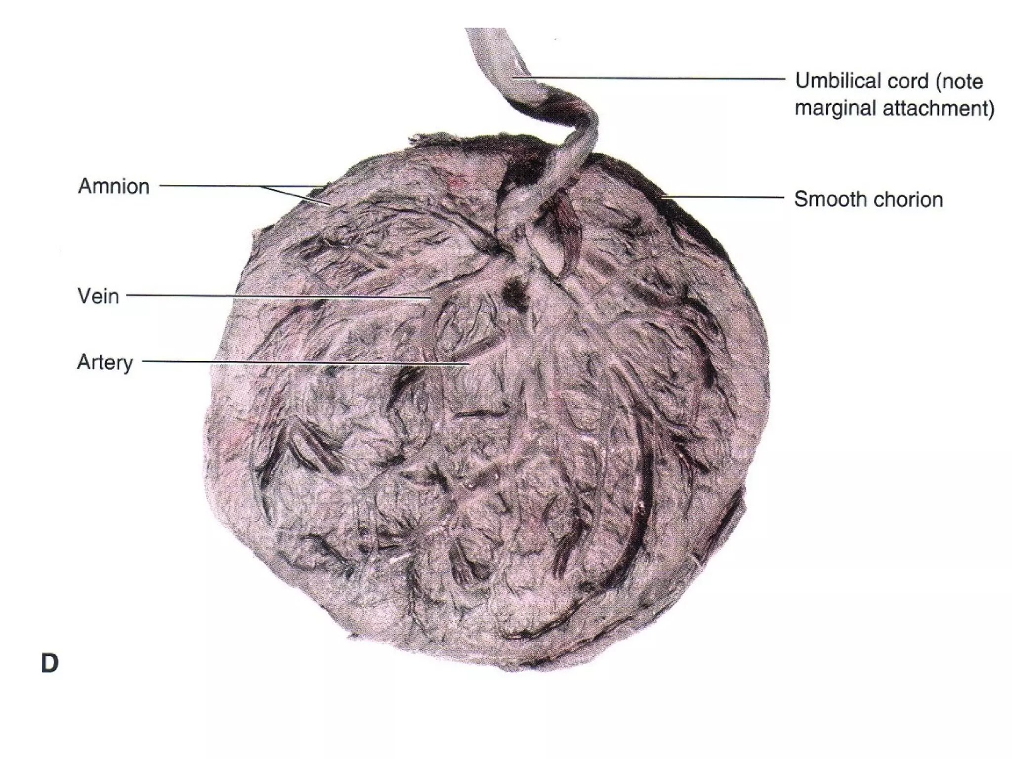 Amnion & Umbilical Cord (General Embryology) | PPS