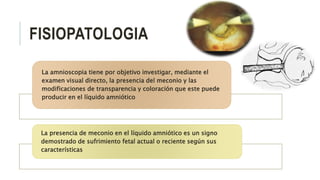 Amnioscopia | PPTX