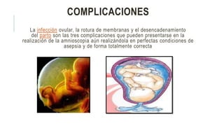 Amnioscopia | PPTX