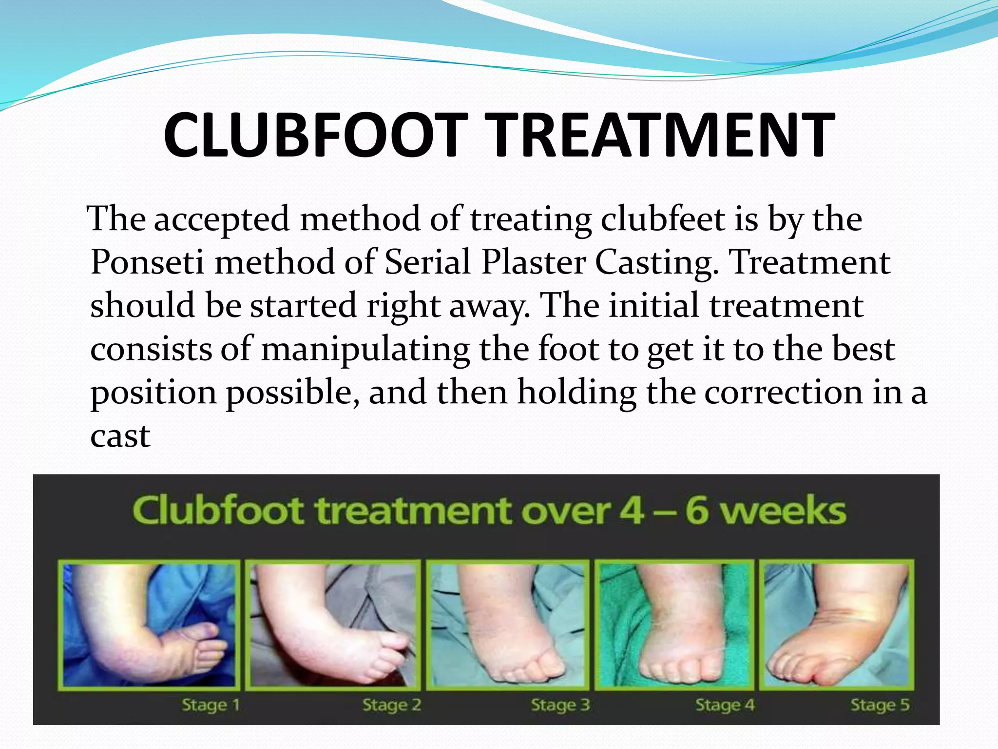 Amniotic band syndrom epptx | PPTX