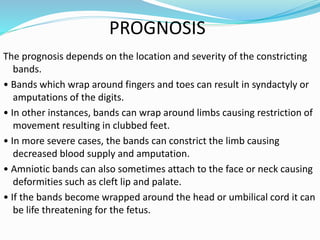 Amniotic band syndrom epptx | PPTX