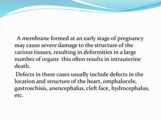 Amniotic band syndrom epptx | PPTX