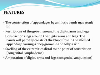 Amniotic band syndrom epptx | PPTX