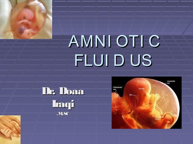 Amniotic fluid ultrasound | PPT | Pregnancy | Reproductive Health