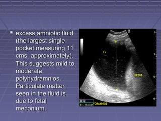 Amniotic fluid ultrasound | PPT