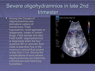 Amniotic fluid ultrasound | PPT