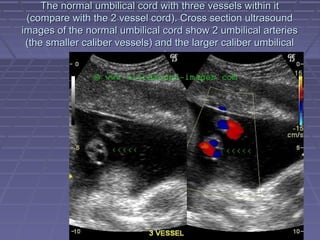 Amniotic fluid ultrasound | PPT