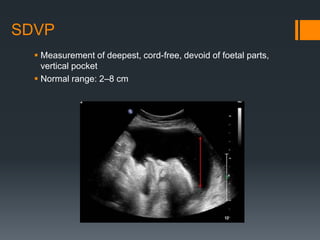 Amniotic fluid | PPSX