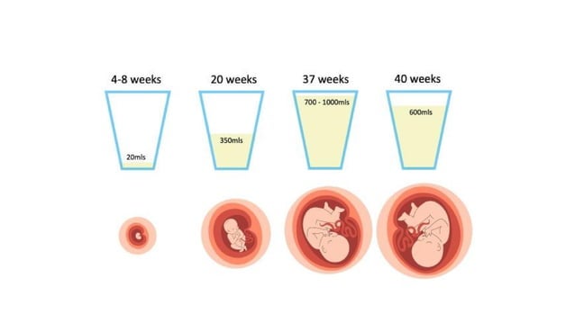 Amniotic fluid-Specimen handling and collection.pptx | Pregnancy ...