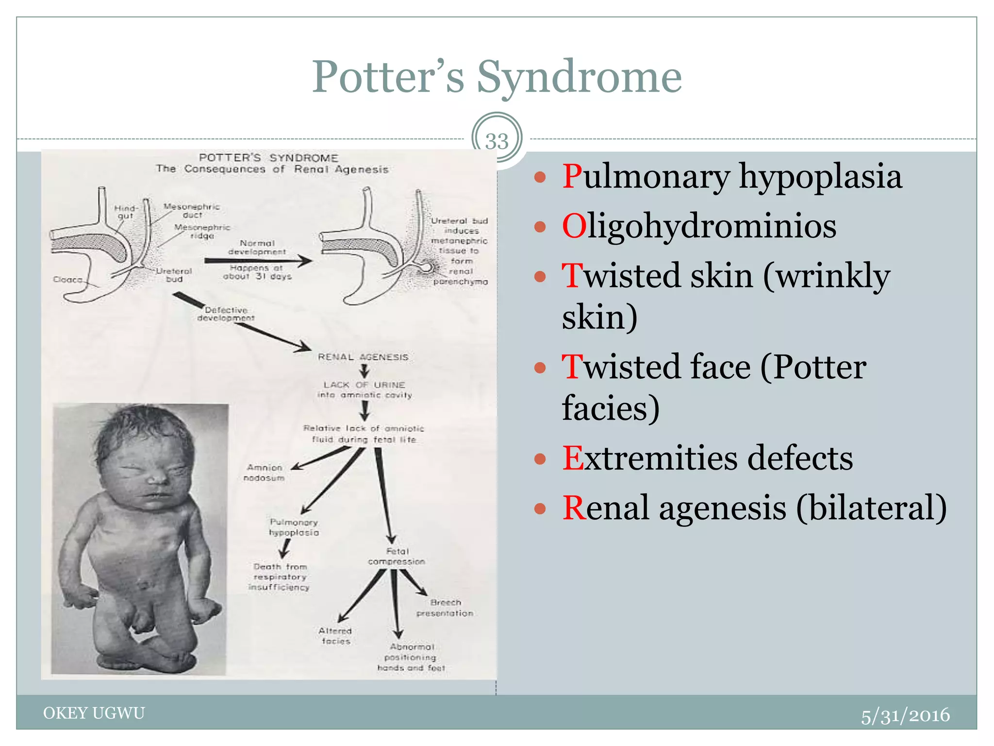 Amniotic fluid disorders | PPTX