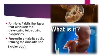 amniotic fluid disorders Presentation (1).pptx