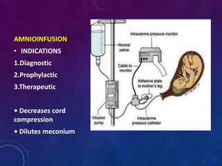 Amniotic fluid & its disorders | PPTX